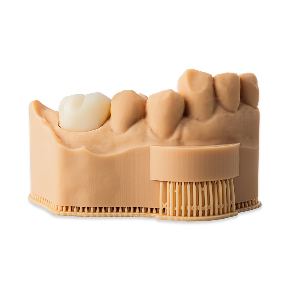 Dental Crown – alias resin