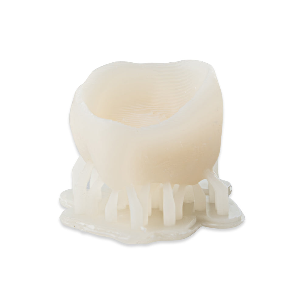 Dental Crown – alias resin